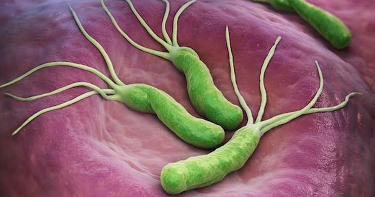 Síntomas de la bacteria Helicobacter pylori: conócelos para prevenir ...